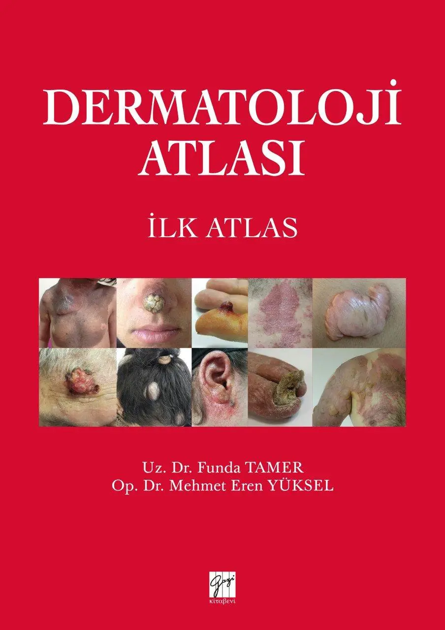 Dermatoloji Atlası- ilk Atlas - 9786053444442