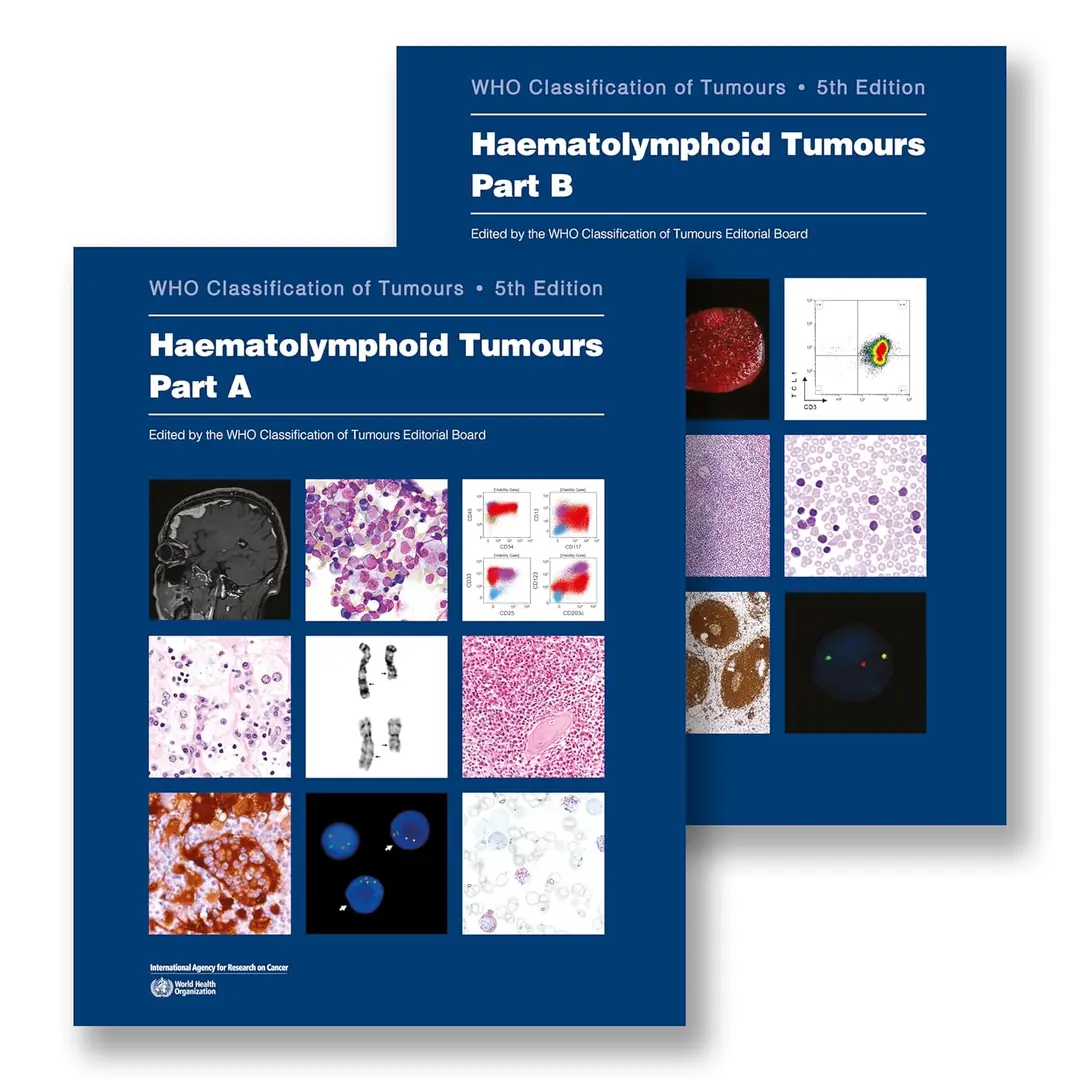 The WHO Classification of Tumours Haematolymphoid Tumours (Volume 11 ...