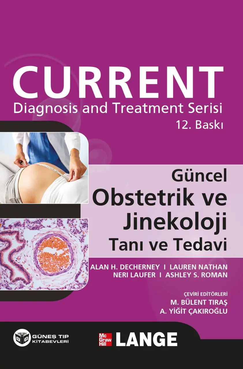 Current Güncel Obstetrik ve jinekoloji Tanı ve Tedavi - 9789752778719