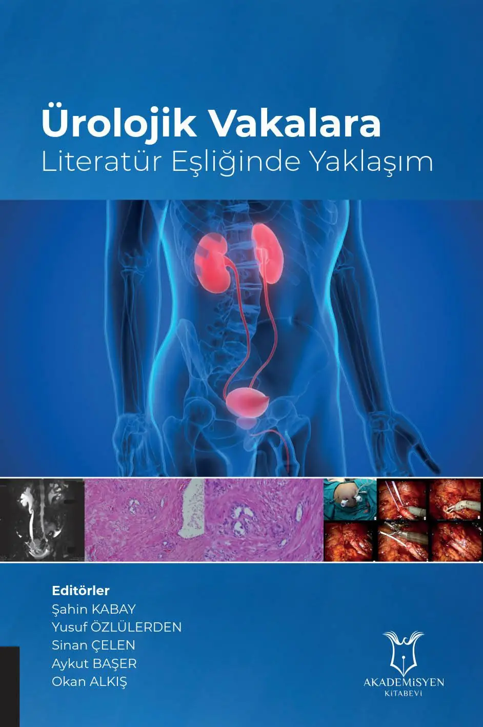 Ürolojik Vakalara Literatür Eşliğinde Yaklaşım - 9786052586471