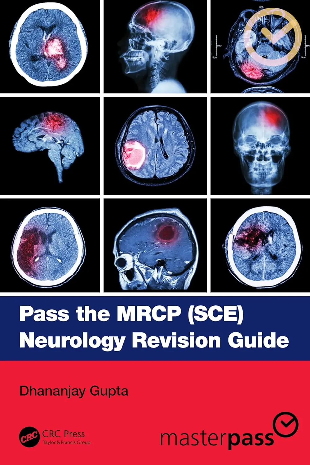 Pass the MRCP (SCE) Neurology Revision Guide