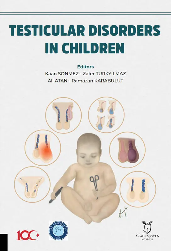 Testicular Disorders in Children - 9786253995522