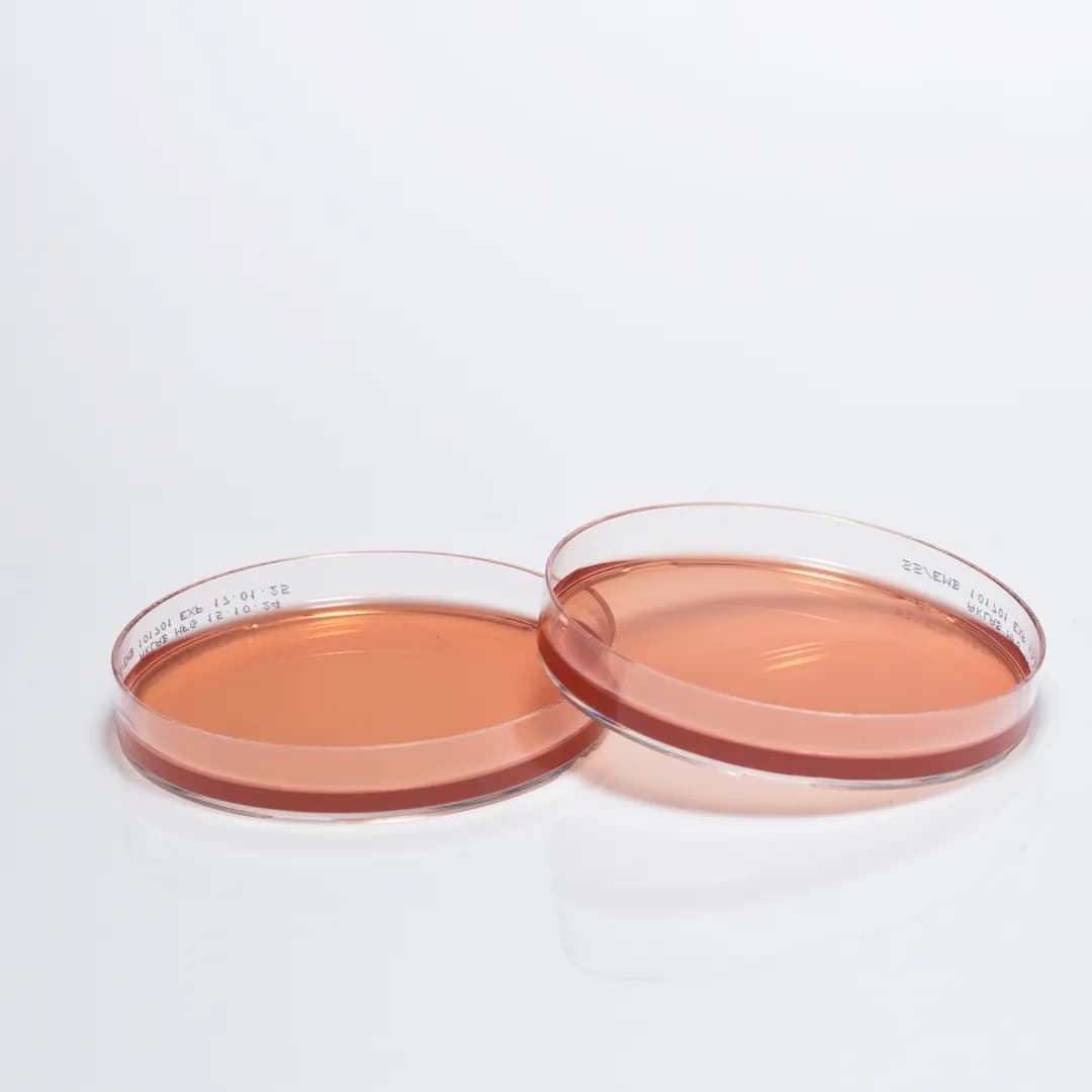 Salmonella Shigella Agar Salmonella Shigella (SS) Agar | Innovation
