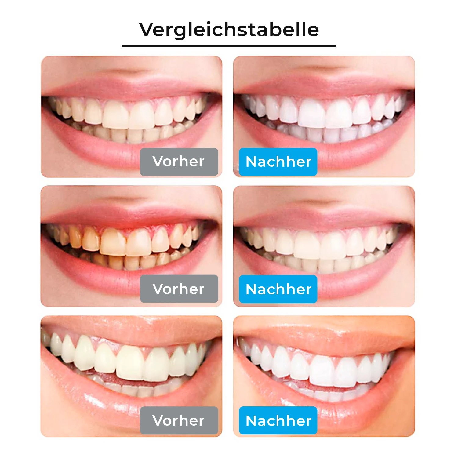 Zahnaufhellung Stift Pen Gel Zahnweiß weiße Zähne Teeth Whitening Bleaching