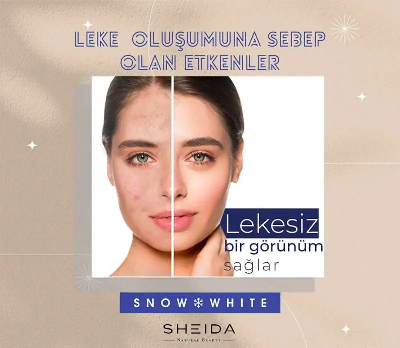 Leke Oluşumuna Sebep Olan Etkenler