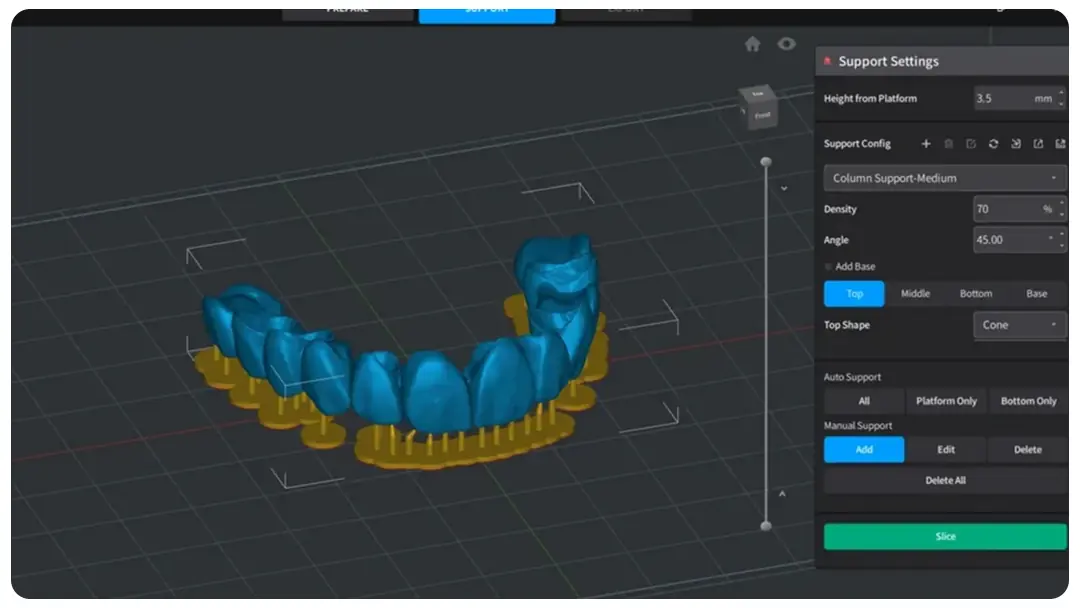 Important Points to Consider When Adding Supports