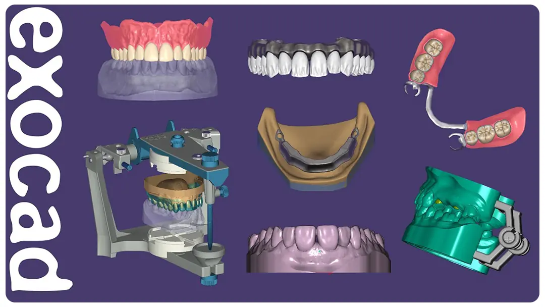 What is Exocad? A New Era in Digital Dentistry