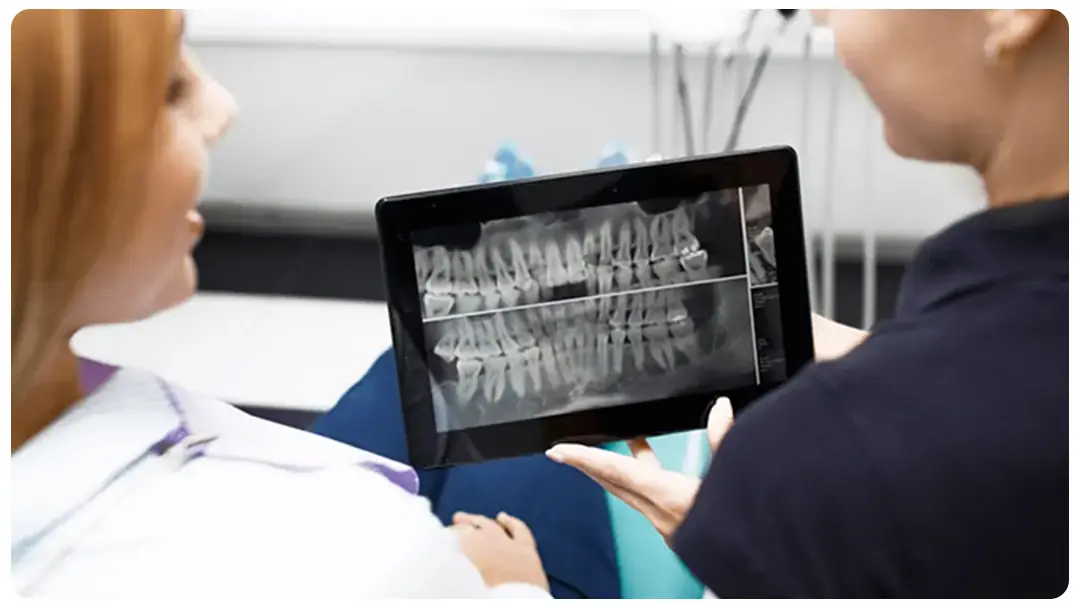 Surgical Guide and Implant: A Revolution in Stitch-Free Implant Treatment