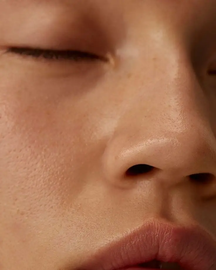 Peeling